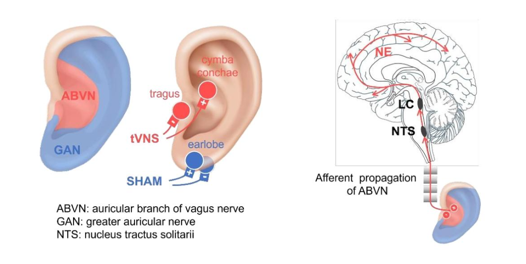 经颅电刺激系列之迷走神经刺激（VNS） - 回映电子科技